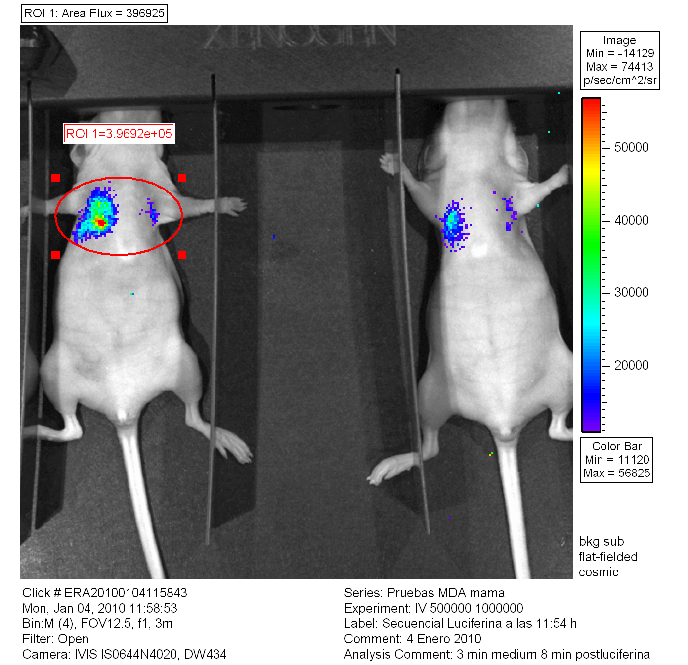 Lung metastasis model | IACS