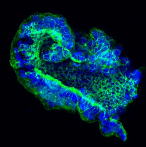 Cinco pasos clave en inmunofluorescencia | IACS